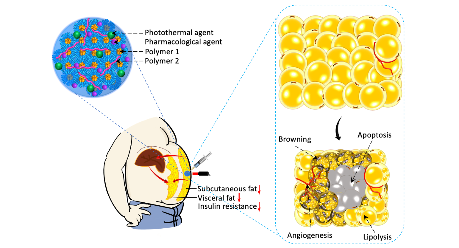 Transdermal Photothermal Therapy for Obesity, Metabolic Diseases, and ...