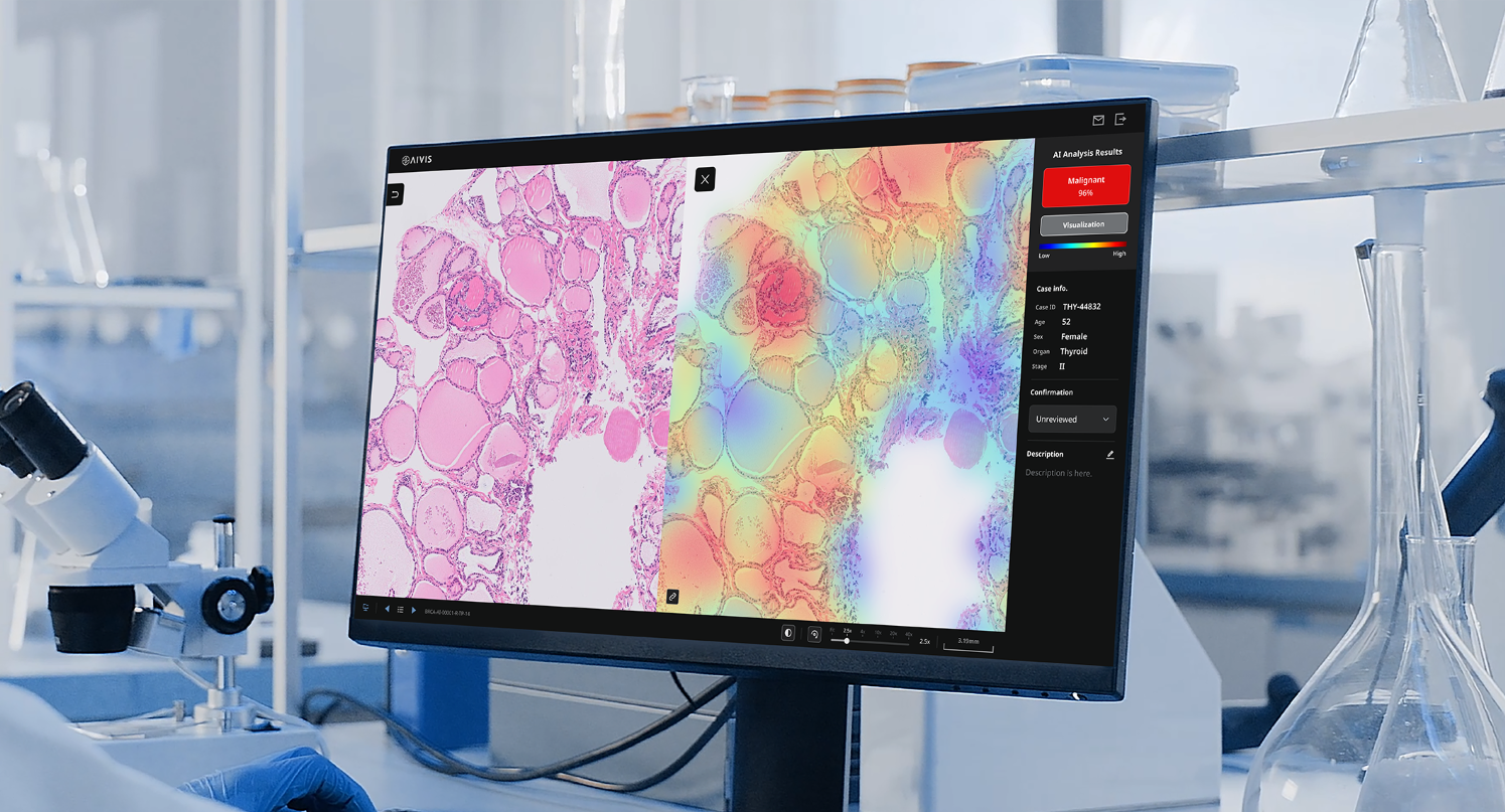 AI-Powered Digital Pathology Solution for Thyroid Cancer Diagnosis